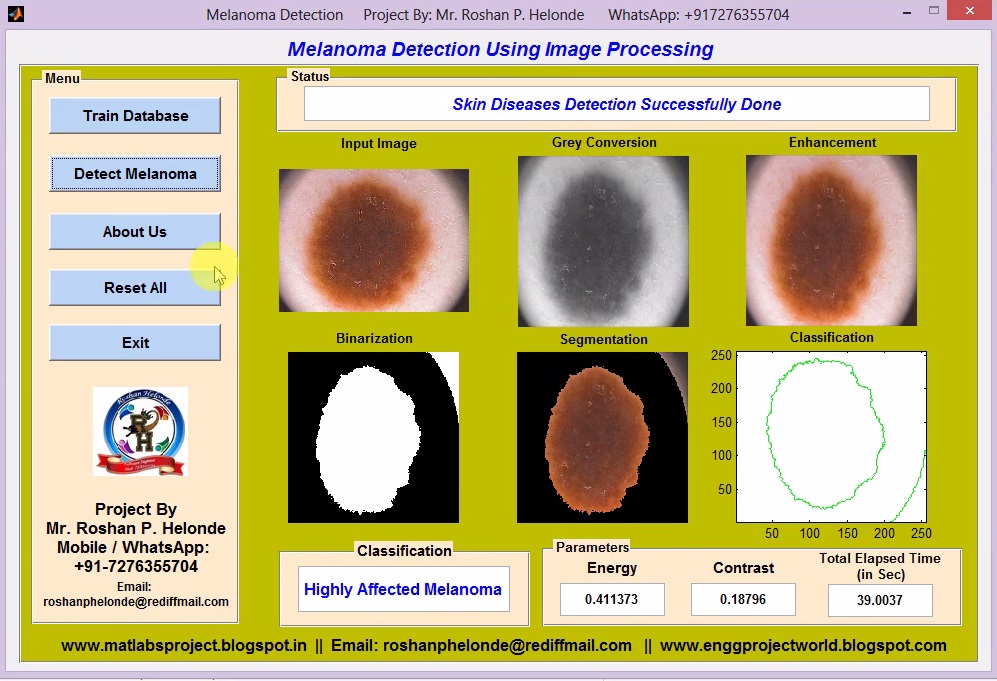 Skin Cancer Detection Using Image Processing Full Matlab Project Code