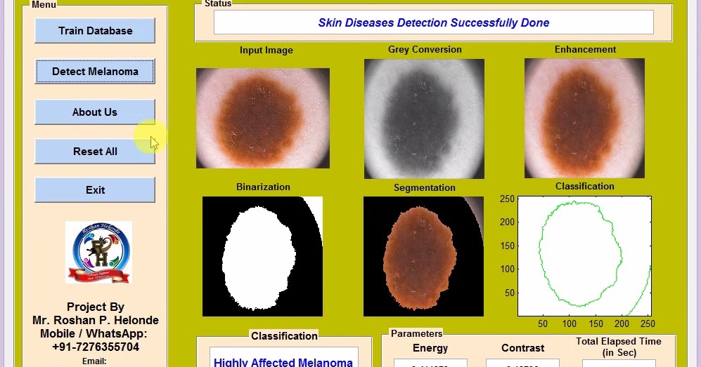 Skin Cancer Detection Using Image Processing Full Matlab Project Code ...