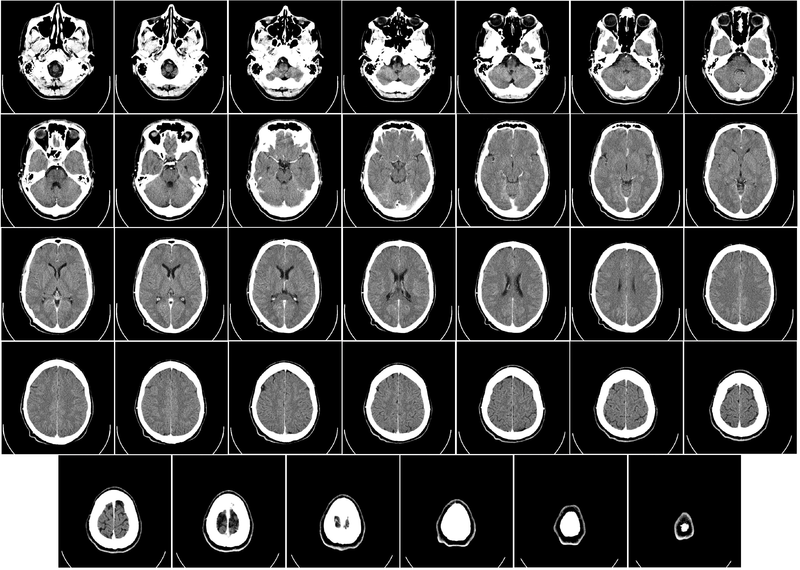 sinaune perawat: Gambaran Normal CT (Computed Tomography) Scaning ...