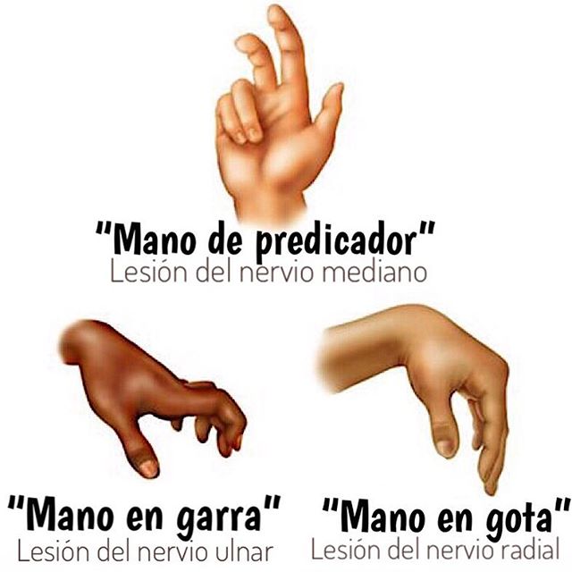 Semiologia de la mano