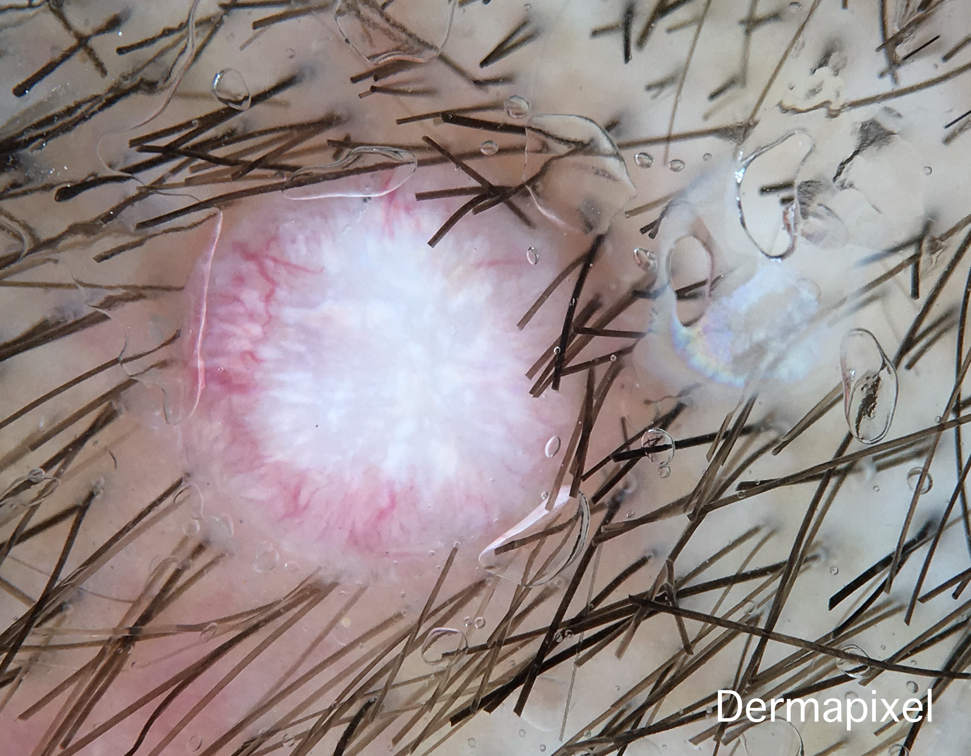 Dermapixel: julio 2021