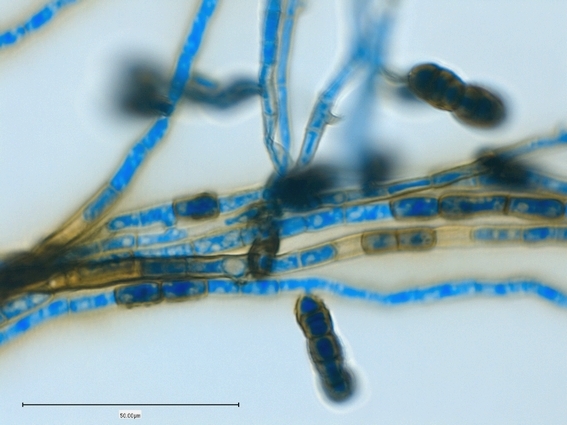 Fun With Microbiology (What's Buggin' You?): July 2015
