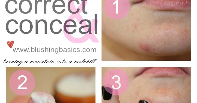 blushing basics: How To Correct & Conceal Acne