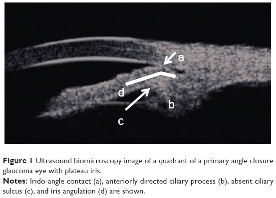GLAUCOMA SPECIALIST BLOG: "THE GLOG"