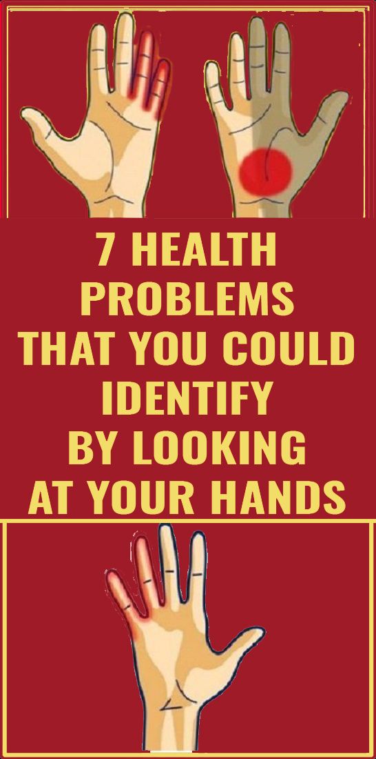 7 Indications Of Overall Health Given By Your Hands | Healthy Hard