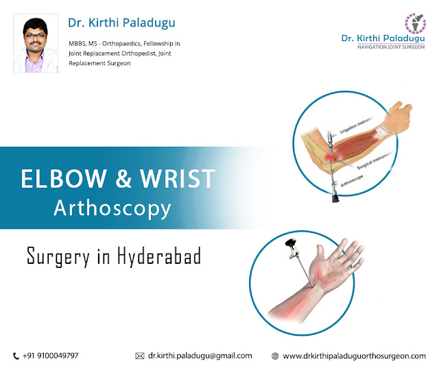 THE TOP 5 ELBOW INJURIES FOR ATHLETES