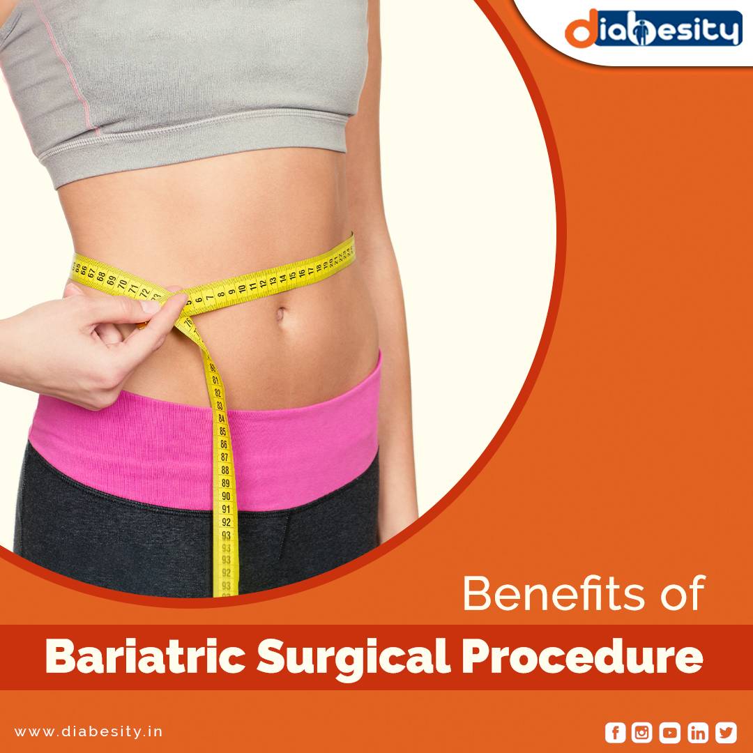 Benefits of Bariatric Surgical Procedure