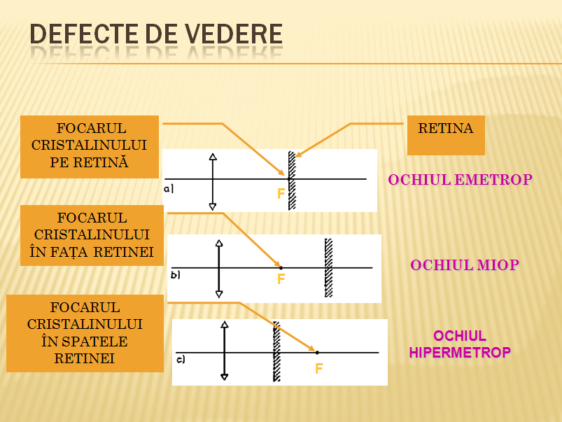 FIZICA INTERACTIVA: Proiect didactic - Ochiul. Ochelarii. Lupa.
