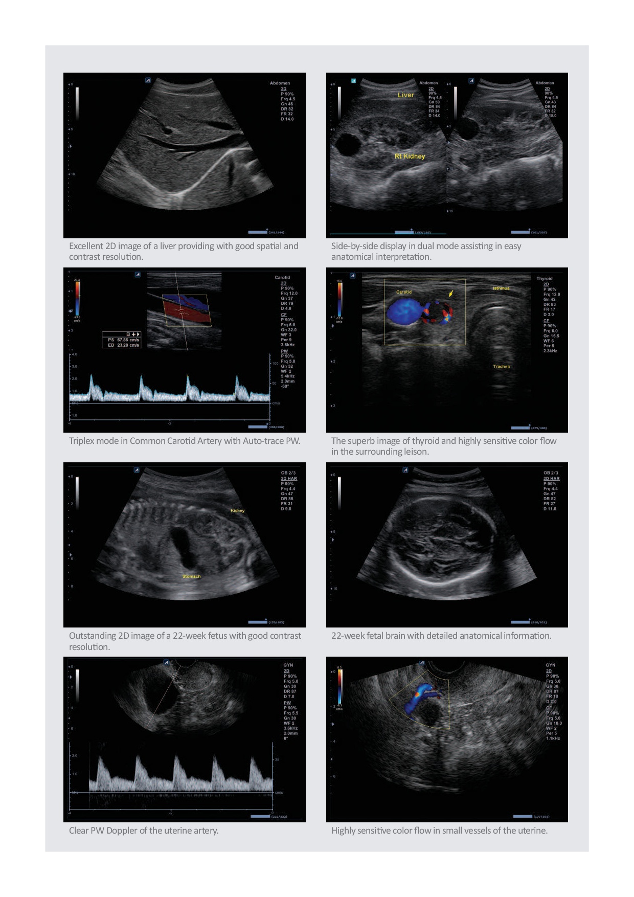 PT. PERWIRA MEDIKA INDONESIA: USG 2D