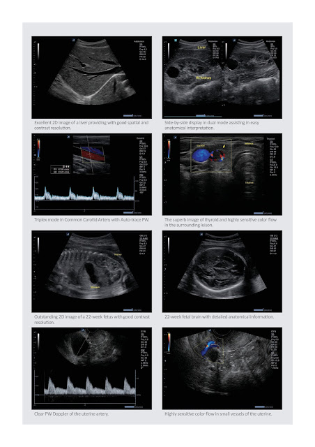 PT. PERWIRA MEDIKA INDONESIA: USG 2D