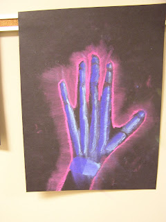 X Ray Hand Drawing