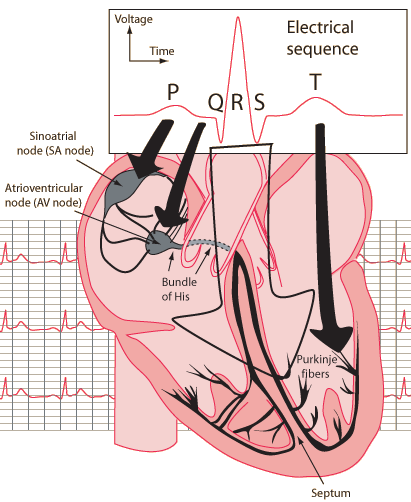 Chest Medicine Made Easy-Dr Deepu: BASICS OF ECG AND EVOLUTION OF MI IN ...