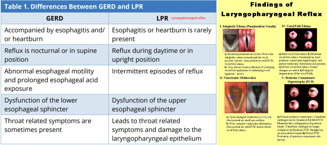 Laryngo-Pharyngeal Reflux Disease(LPR) Vs GERD