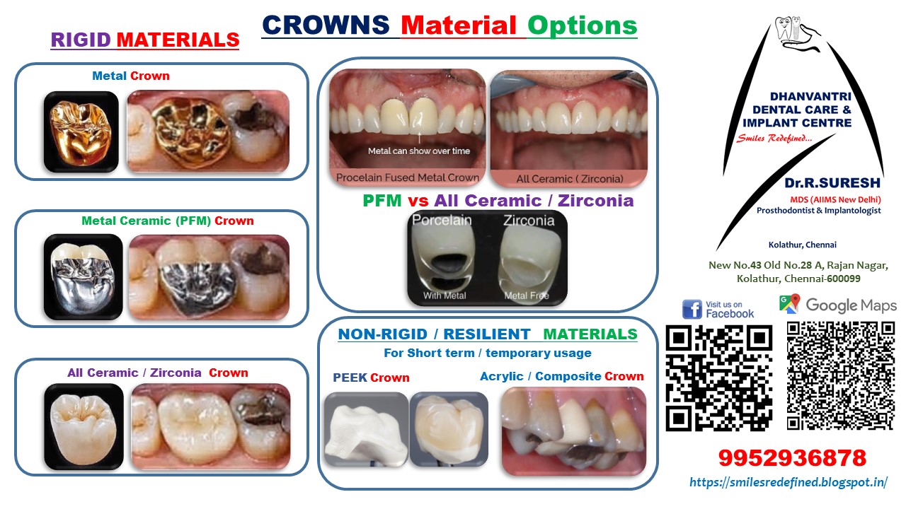 CROWNS - types and materials