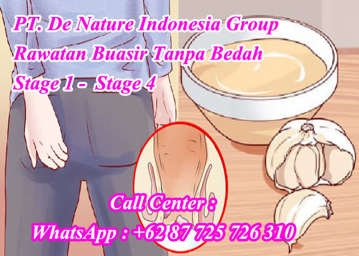 ubat melegakan buasir selamat