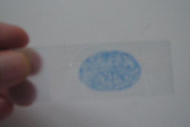 Pengecatan Bakteri Tahan Asam (BTA) ~ Analis Kesehatan Indonesia