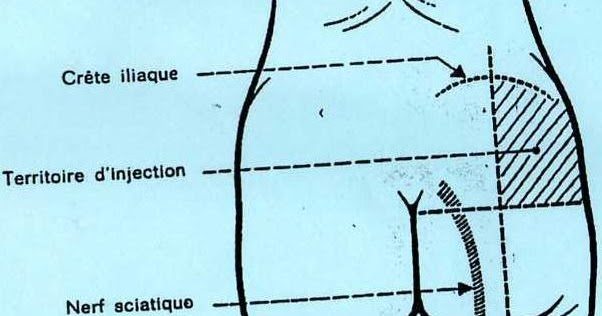 L'amour est patient... et nous aussi!: Questions fréquemment posées