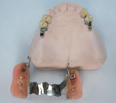 Odontologia com carinho: Próteses Removíveis