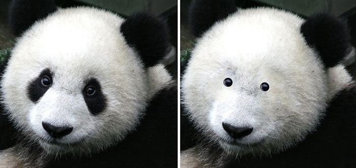 Eyelid Surgery by Prof Dr CN CHUA 蔡鐘能: Doc, Would I Look Ok for Chinese ...