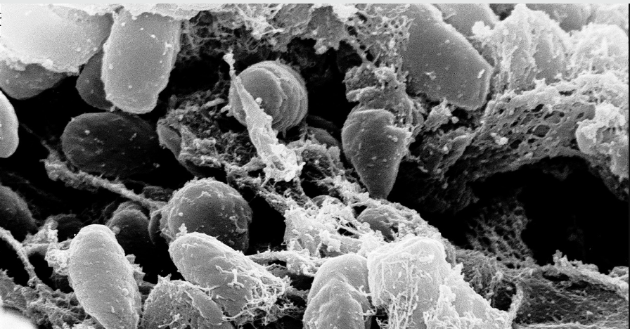 Apa itu Scanning Electron Microscope (SEM) dan Prinsip Kerja SEM