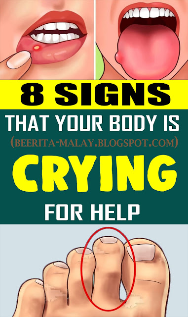 HEALTH 8 SIGNS THAT YOUR BODY IS CRYING FOR HELP - HEALTH and WELLNESS