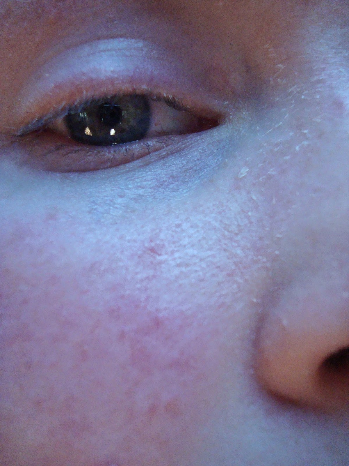 Scarlet Letters, dealing with vascular rosacea, face flushing, burning ...