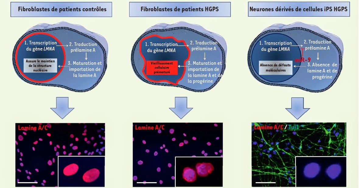progeria family circle: biologie