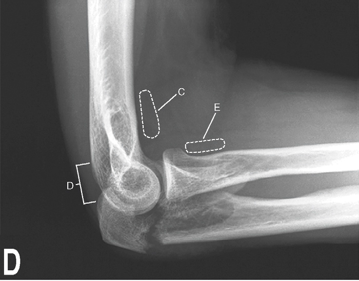 CONTEXTUALIZACION ANATOMICA: codo