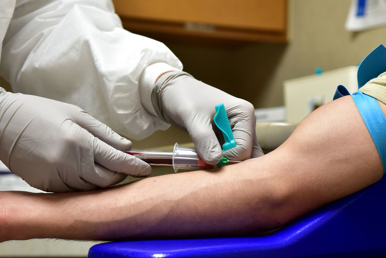 Blood Extraction ppt