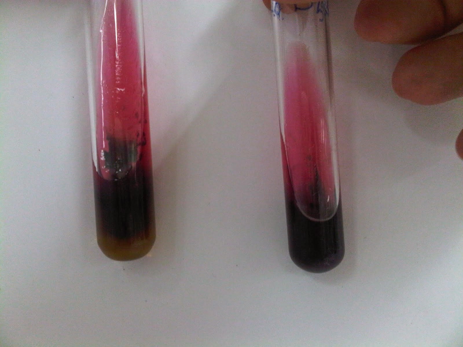 Laporan Praktikum Mikrobiologi Umum Identifikasi Bakteri Melalui Uji ...