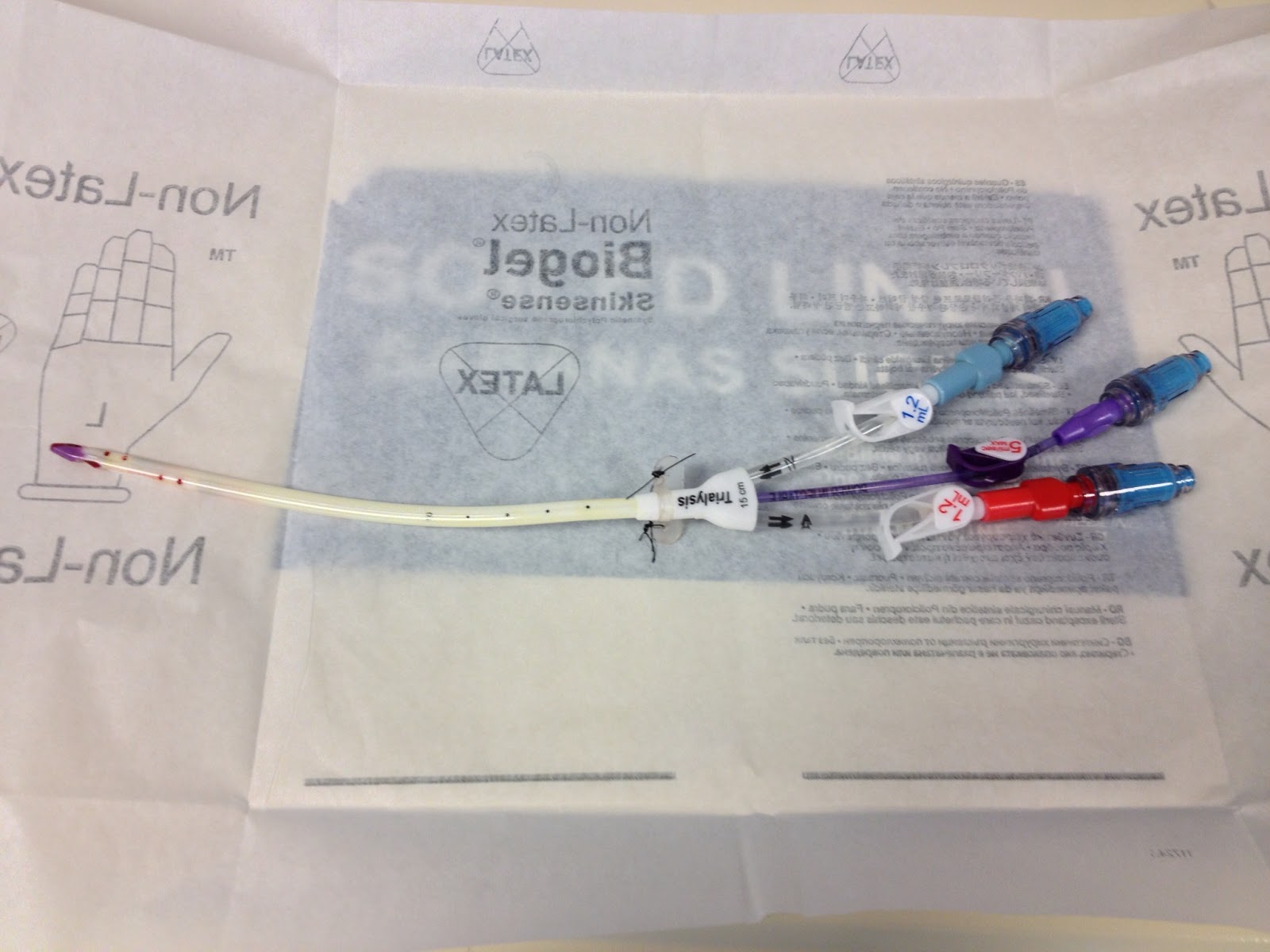 My SCT Journey for CIDP: VASCath Placement and the Harvest