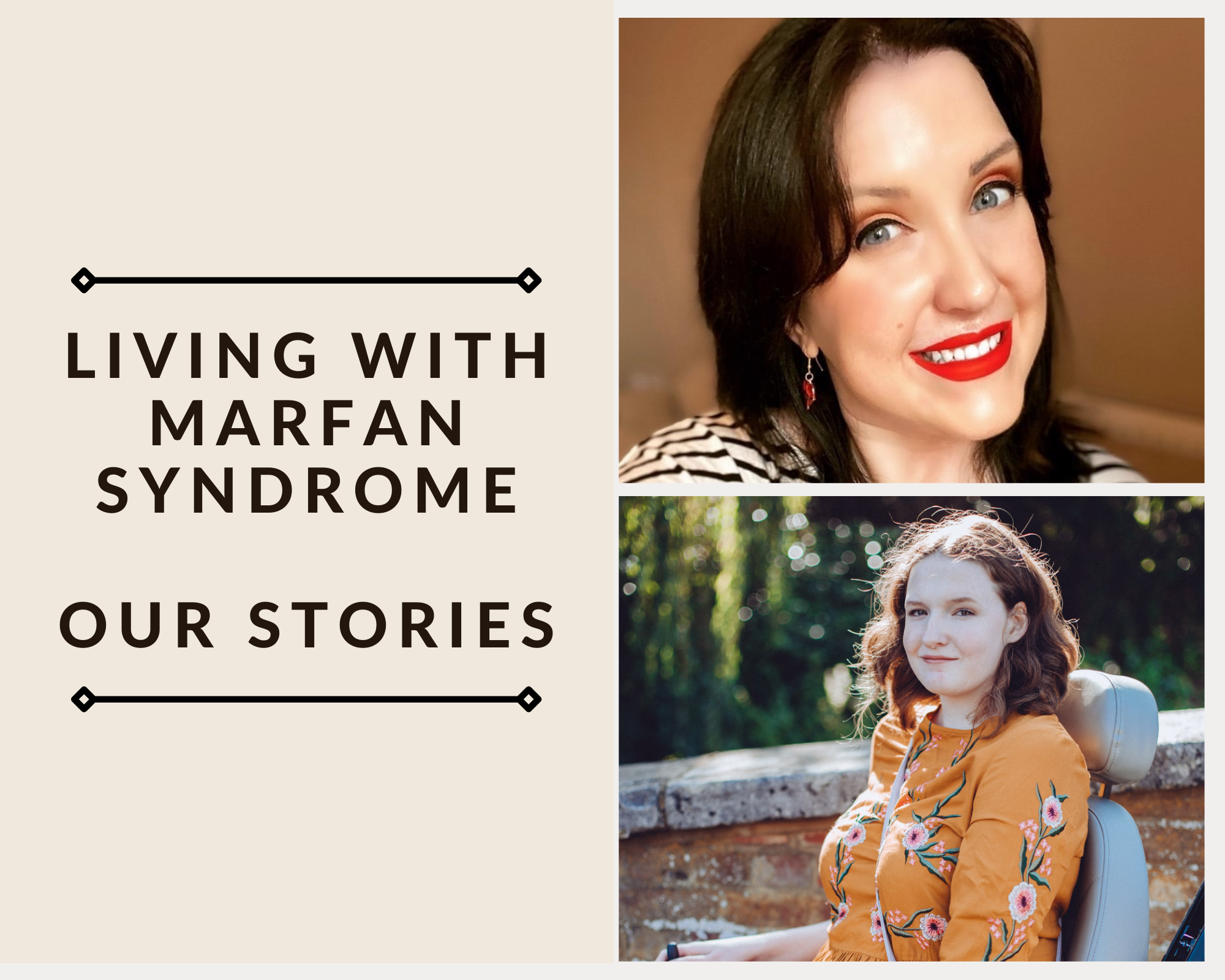 Living With Marfan Syndrome | Our Stories