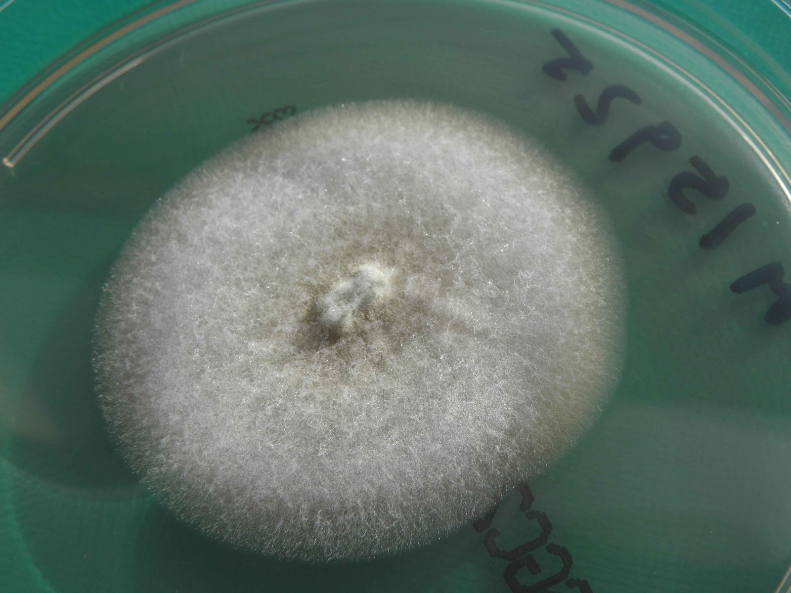 ATLAS MICOLOGIA: ASPERGILLUS TERREUS