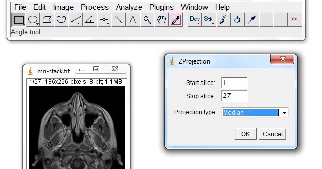 My imageJ: เมนู Image with ImageJ [ตอนที่ 29] Stacks, การแสดงภาพด้วย ...