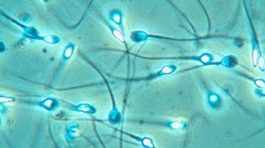 Test postcoital o test de Hühner - Embarazo Online