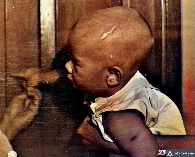 One-Year Old Baby with Bayonet Scar on his Head - Batangas History ...