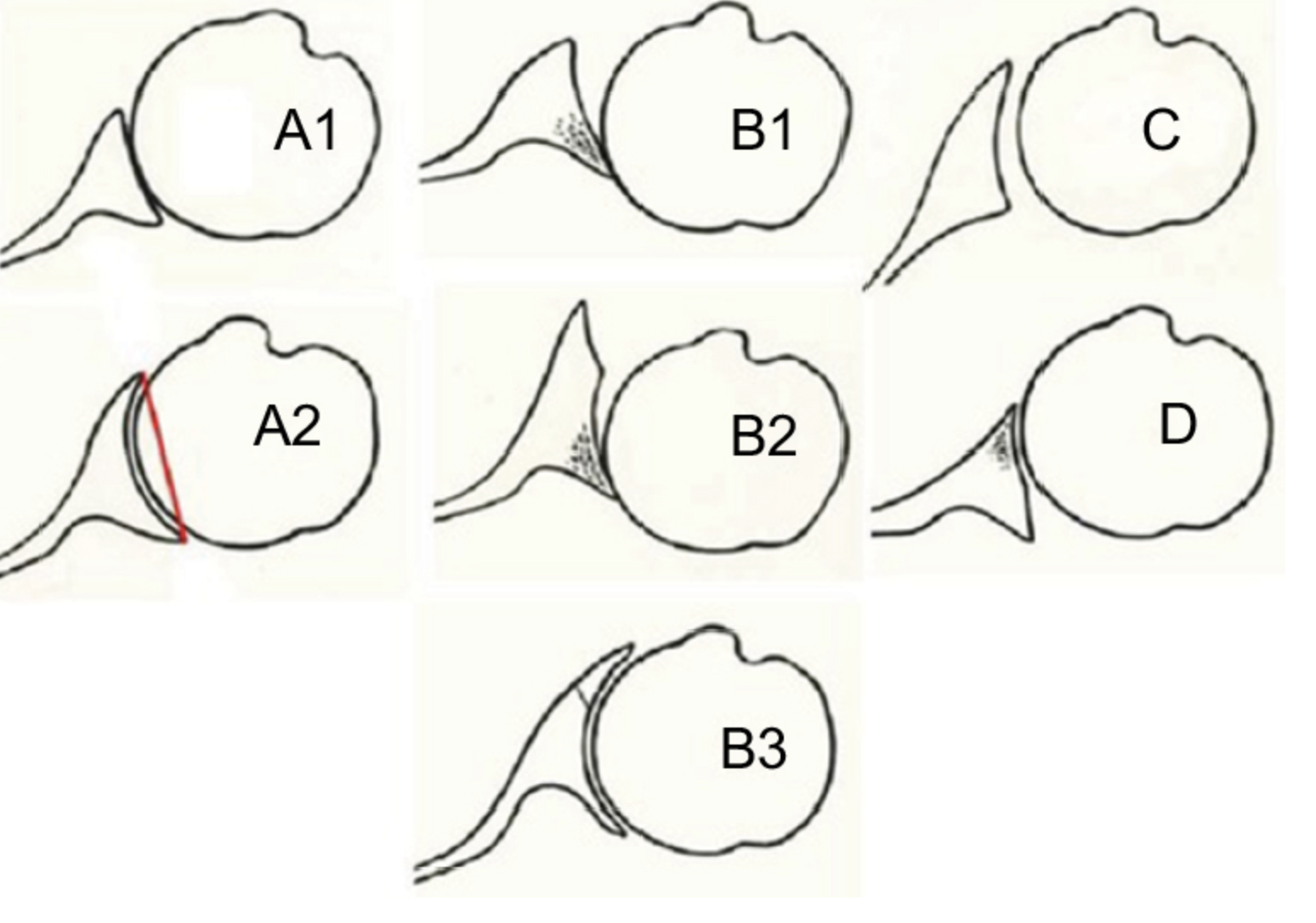 Shoulder Arthritis / Rotator Cuff Tears / Shoulder Pain : Anatomic ...
