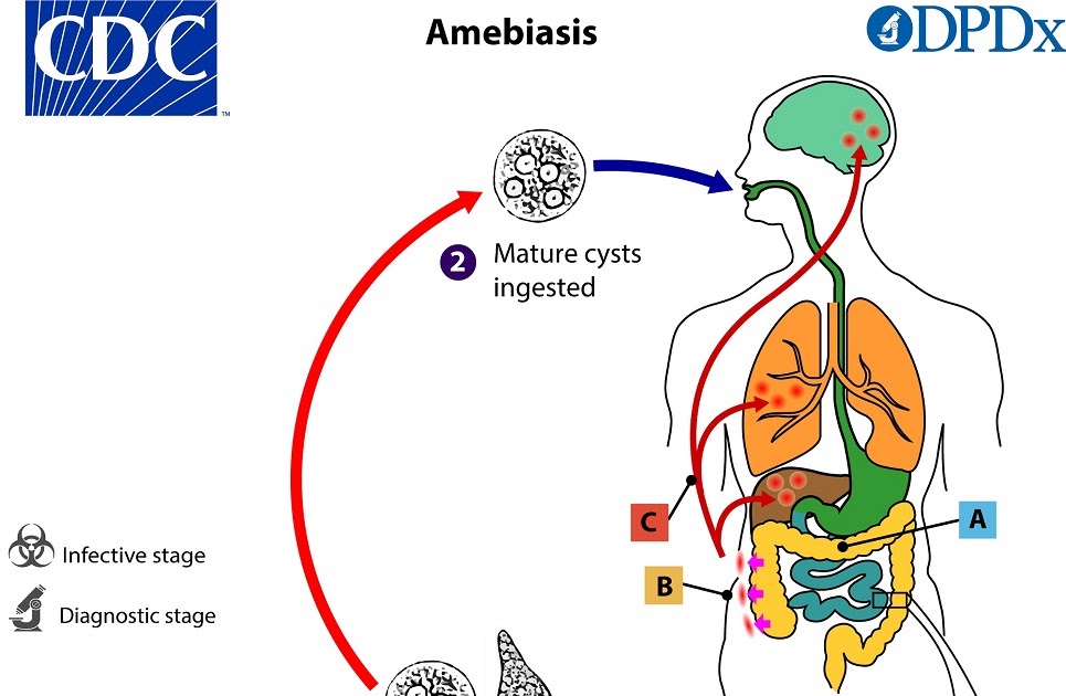 My Scientific Blog - Research and Articles: Amoebiasis