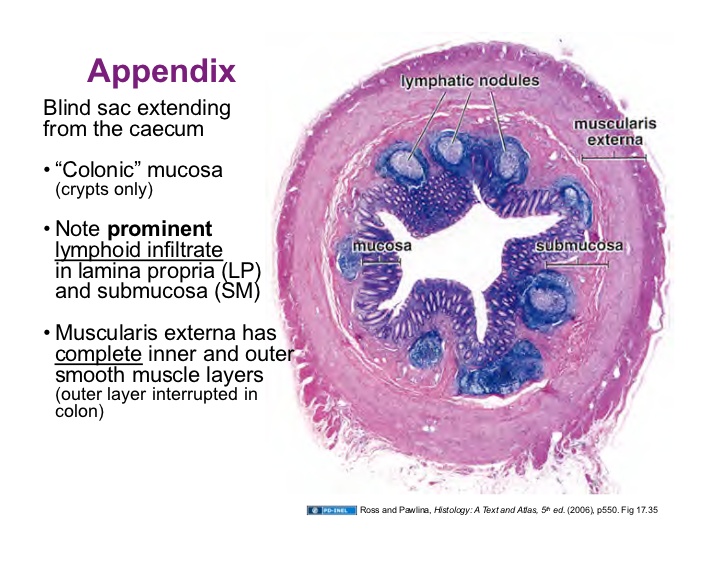 Appendicitis-Naturally cure with Home Remedies - Kuwait Busses