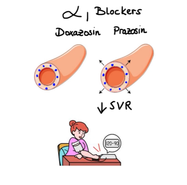 【Pharmacology】Antihypertensive