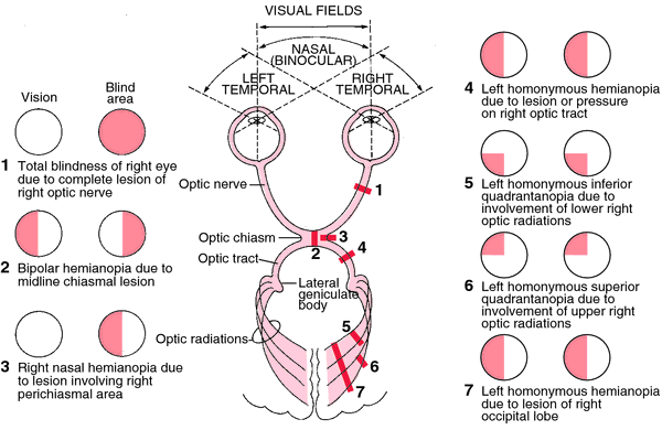 ER goldbook: Common Eye Emergency: eyelid, retina, vascular, nerve