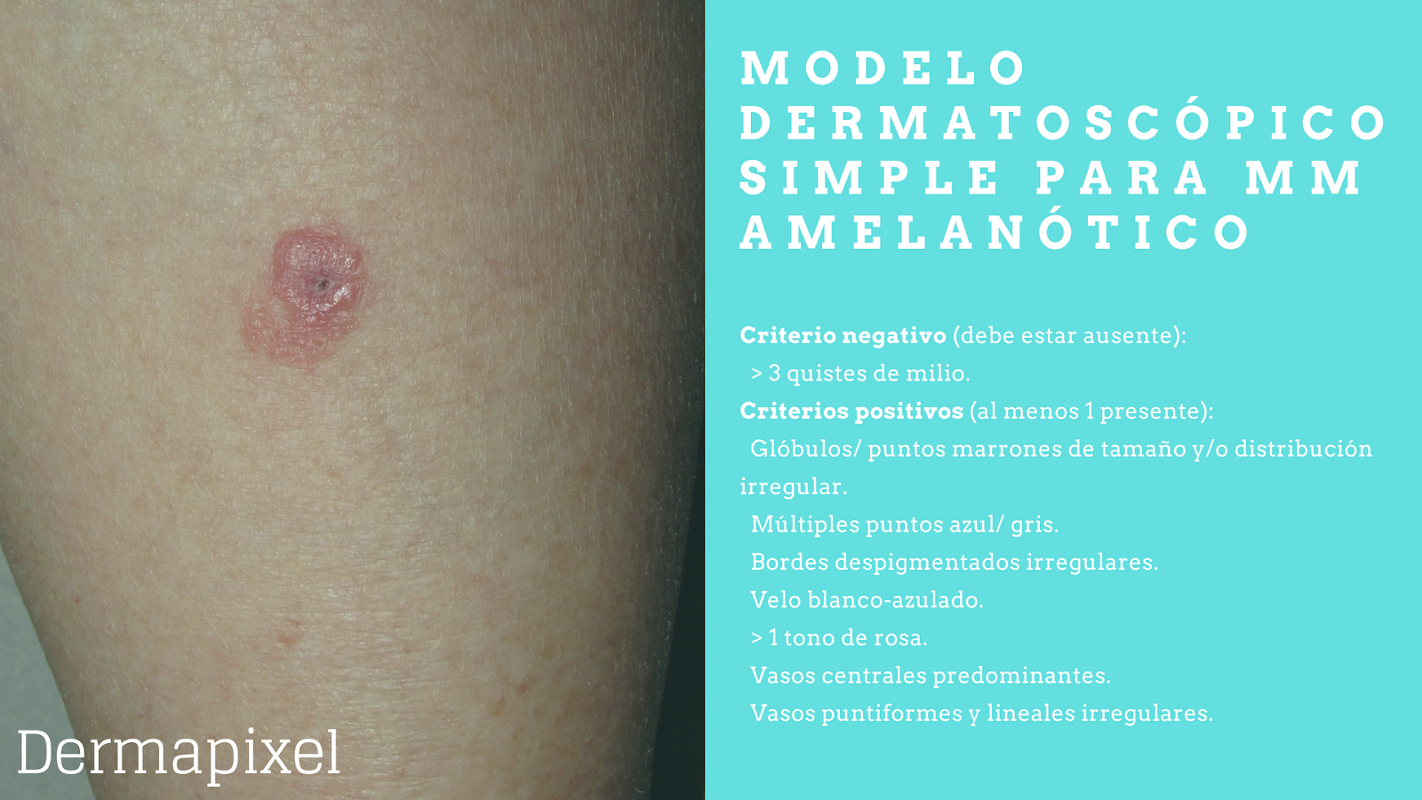 Dermapixel: mayo 2018