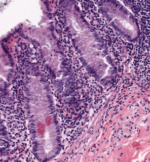 MoyinAdesanyaBiol 3500: The Human Appendix: My Favorite Organ: The ...