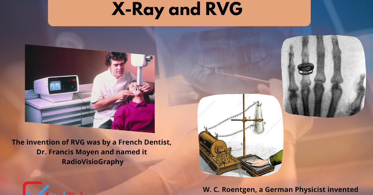 Know more about X-Rays & RVGs