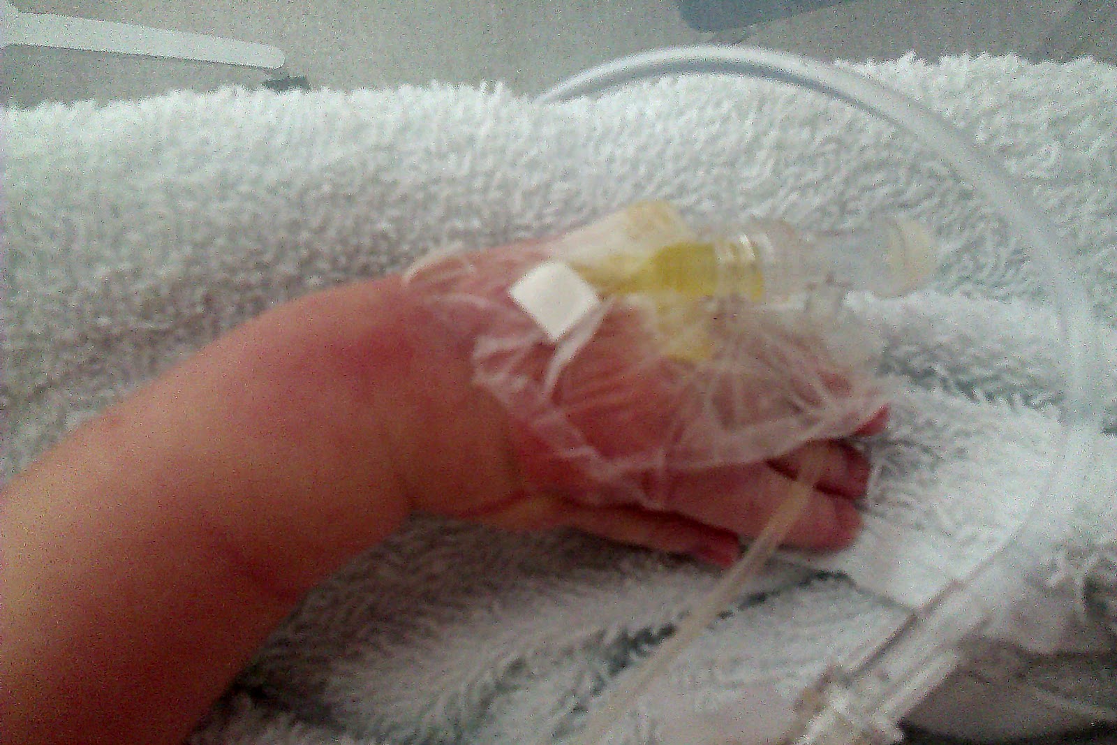 IV cannula (Medical students)