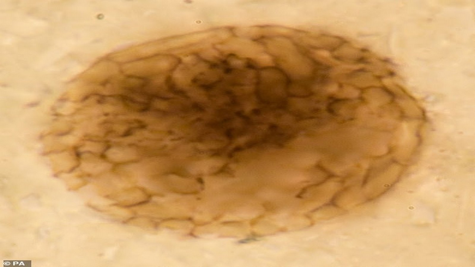 Is THIS the missing link in the evolution of animals? A BILLION-year ...