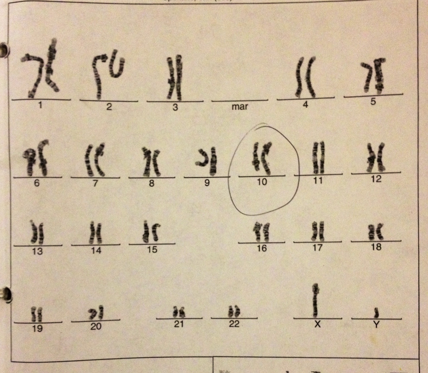 One Day At A Time: What Is A Chromosome Disorder?