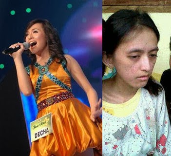 Decha Stardut Meninggal Dunia di Usianya Yang Masih 22 Tahun - SlideGossip