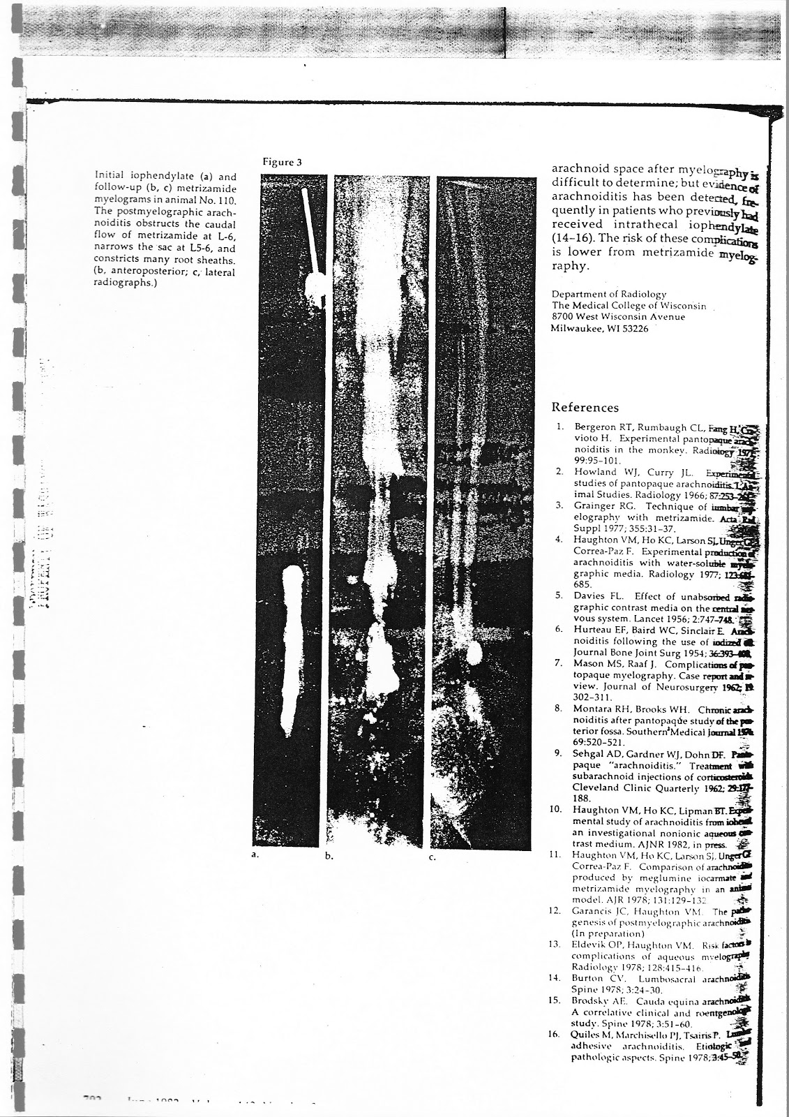 Myodil Killer: 10. Pantopaque and Metrizamide tests on monkeys