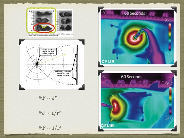 Dr Han Naung @ Henry Han : Electrophysiology and Heart Rhythm ...